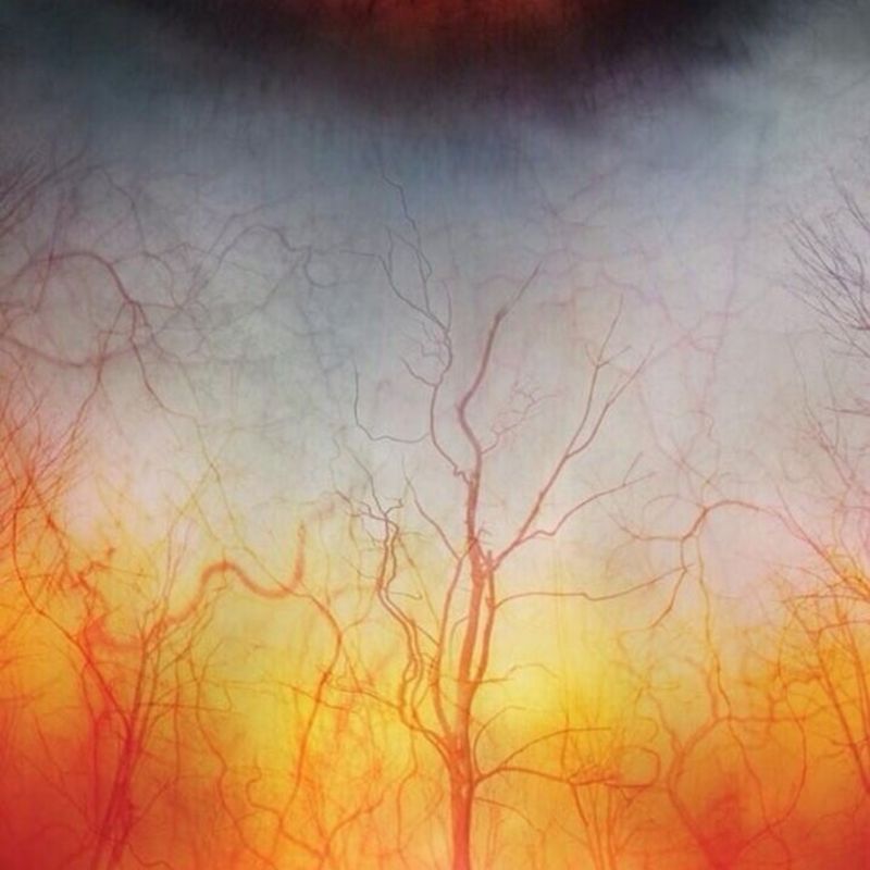 Eye forest | NFT Collection | Airnfts